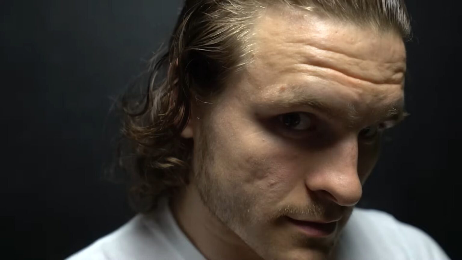 How To Get Rid Of Indented Acne Scars: Ditch the Dimples