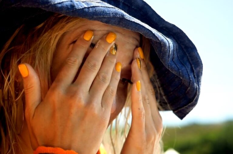 How To Get Rid Of A Frostbite Scar? Follow These Methods and Additional ...